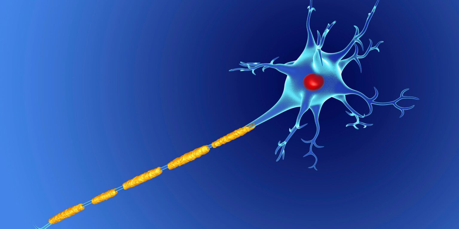 Understanding Multiple Sclerosis: A Comprehensive Overview – Voyage Medical